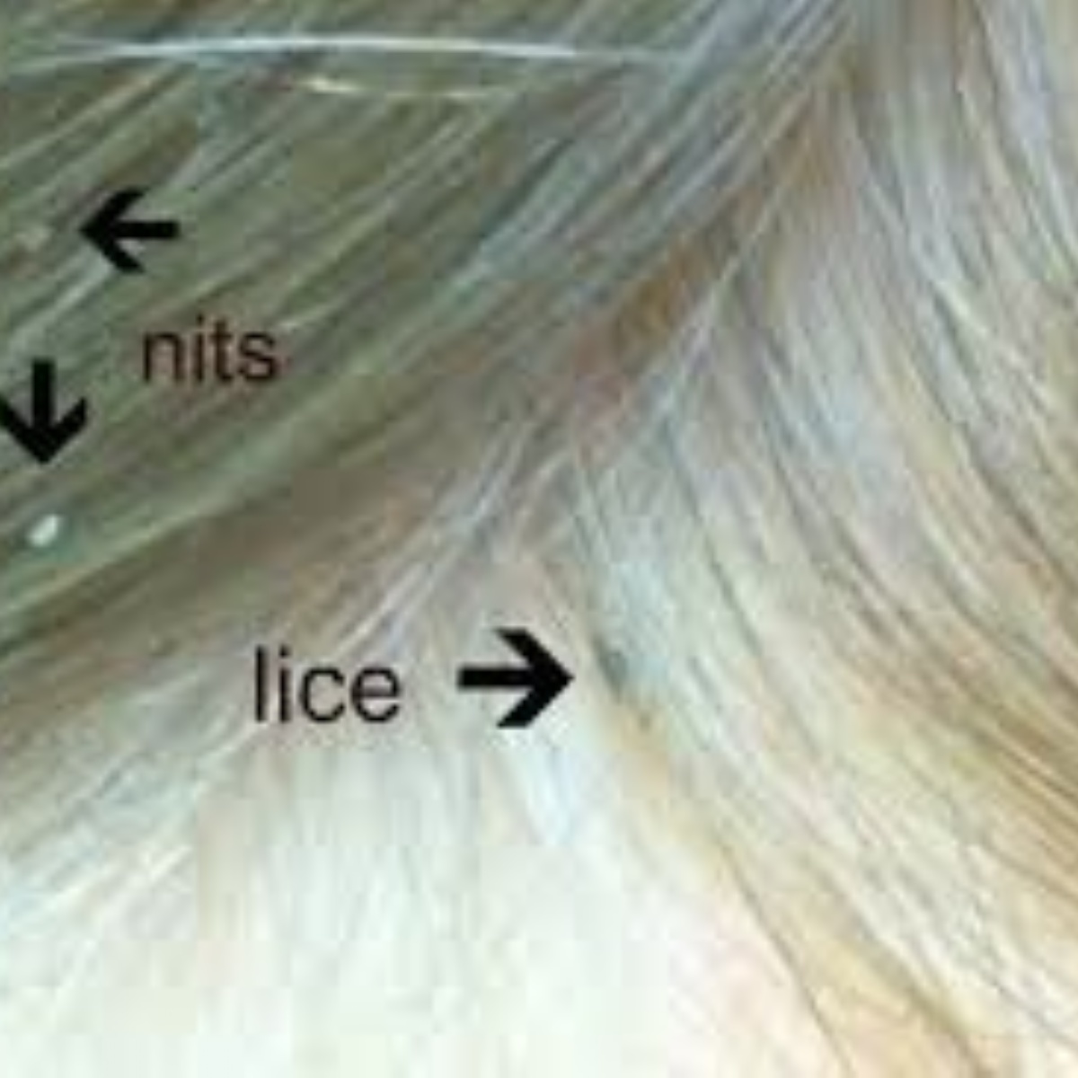 Brockenhurst C of E Primary School - Nits in Year 5